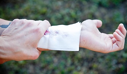 First-Aid Manual: Treat a Gaping Wound