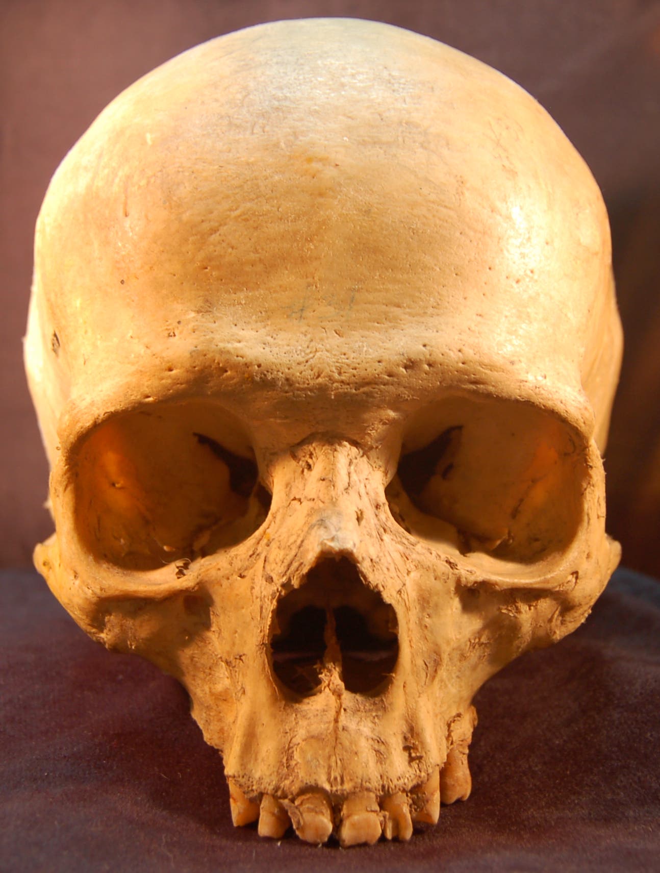 Hiker Finds Human Skull Near Nederland